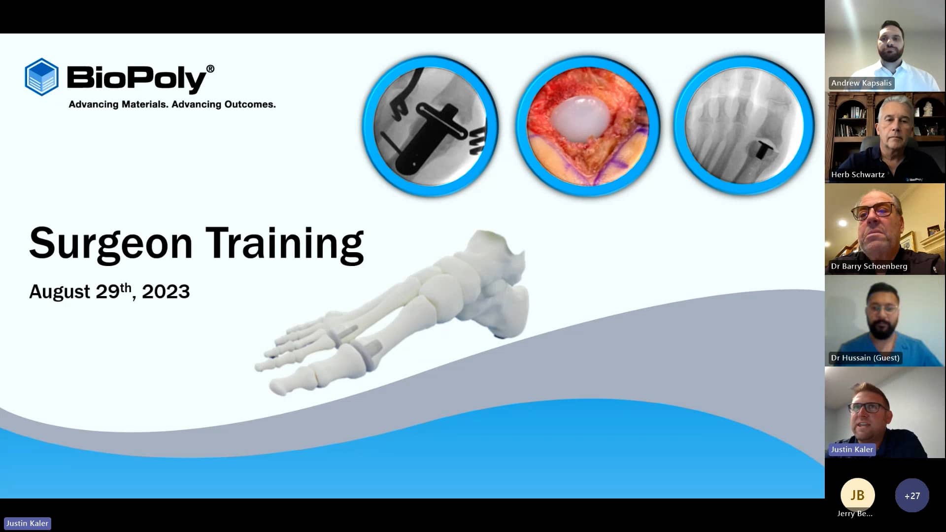 8.29.23 BioPoly Great Toe Surgeon-to-Surgeon Webinar on Vimeo