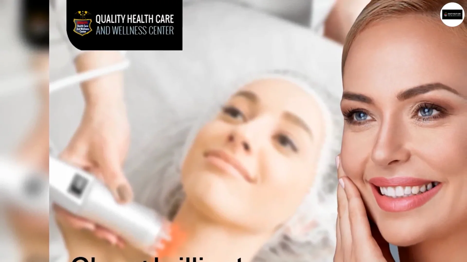 Clear and Brilliant Laser Treatment in New Jersey - Quality Healthcare ...