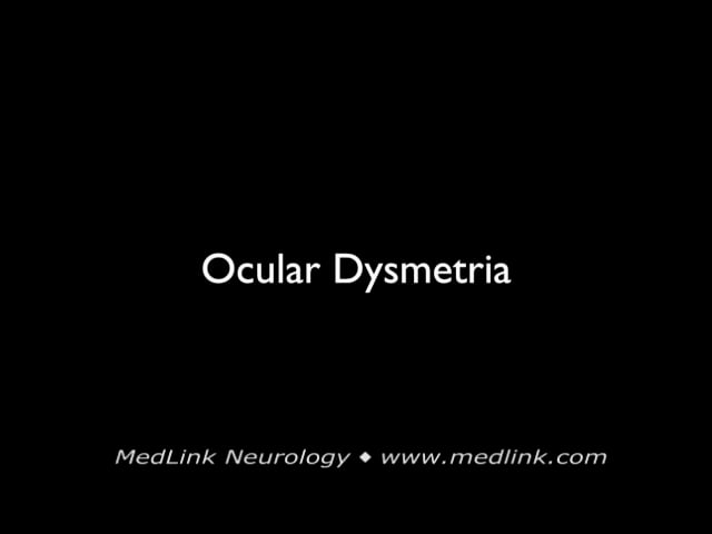 Nystagmus | MedLink Neurology