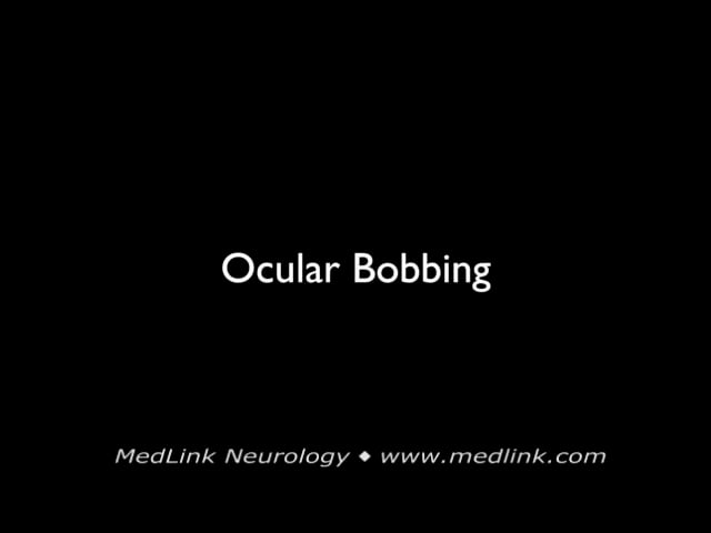 Nystagmus | MedLink Neurology