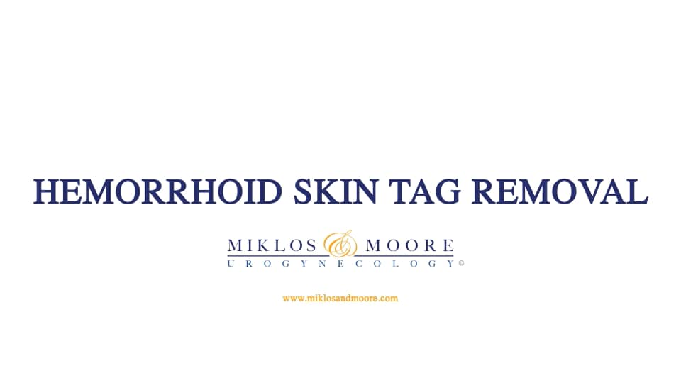 Hemorrhoid Skin Tag Removal on Vimeo