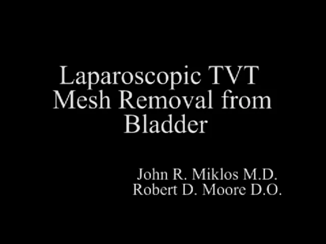 Laparoscopic TVT Mesh Removal From Bladder on Vimeo