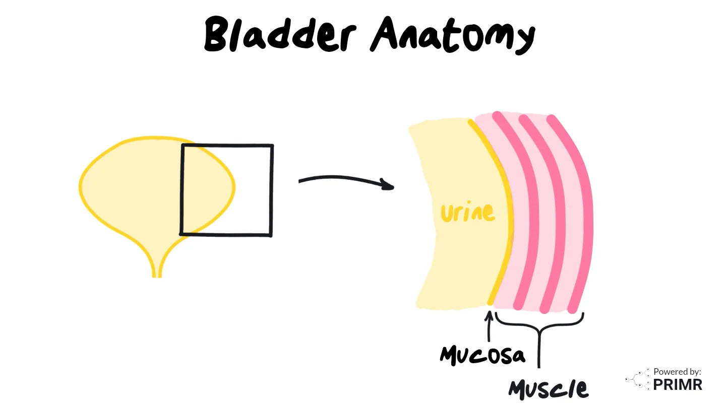Bladder Cancer Anatomy on Vimeo