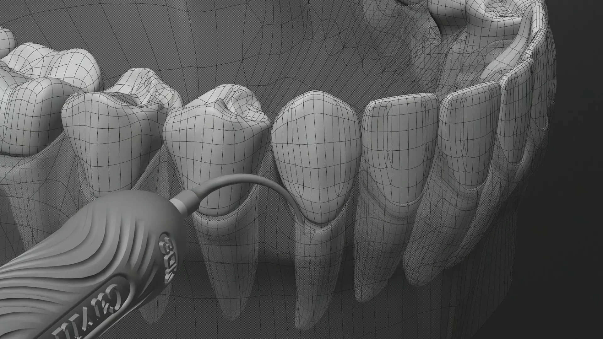 Cavitron Slimline Curved RL Insert v1 on Vimeo