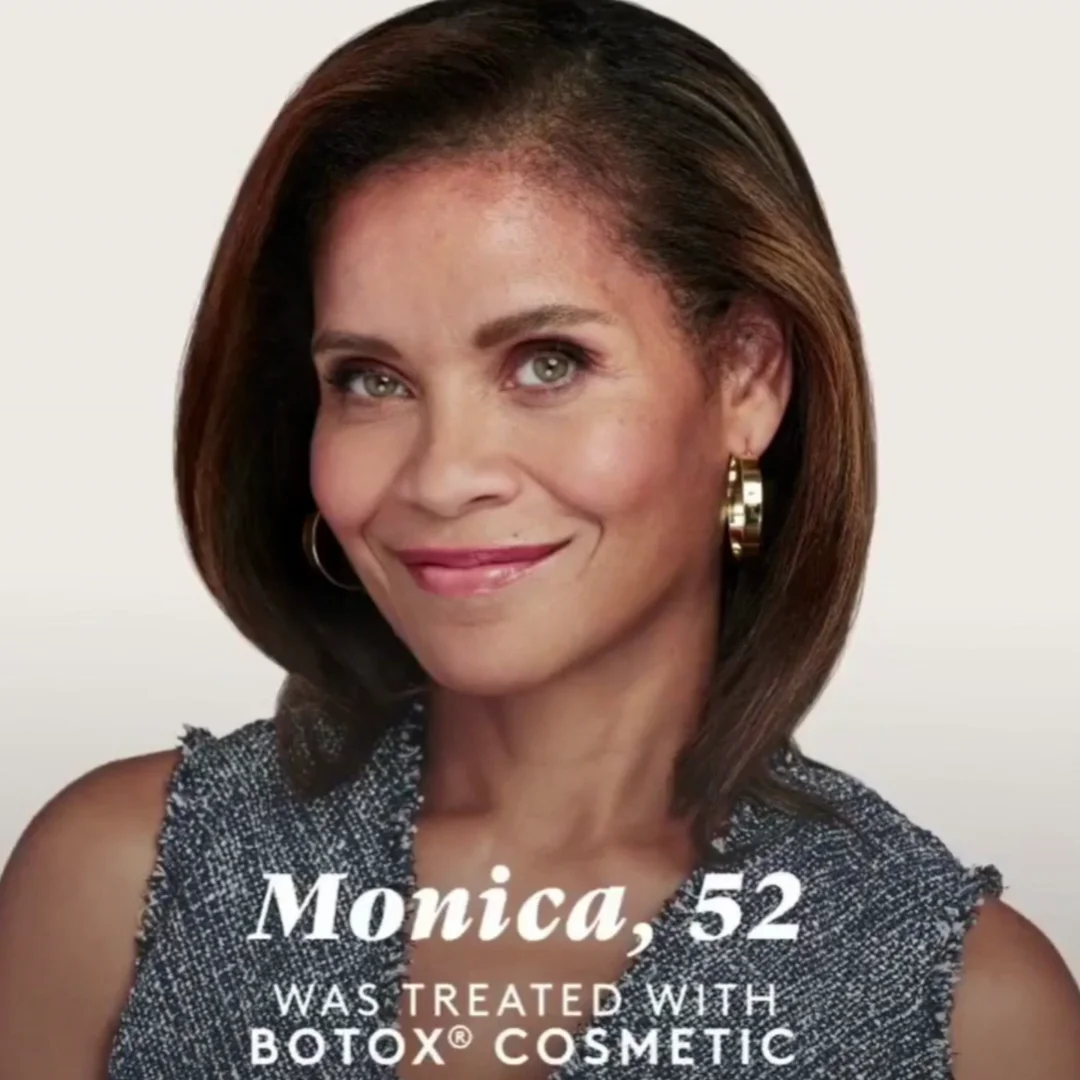 3. Botox - Monica B+A's (Forehead & Frown Lines + Crows Feet) on Vimeo