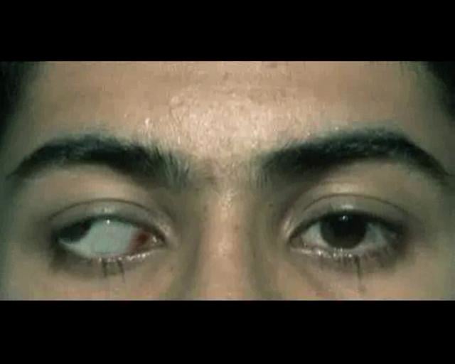 Eyeball Rotating effect on Vimeo