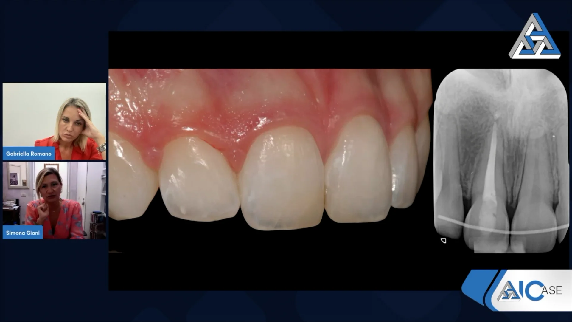 AIC Case Simona Giani on Vimeo