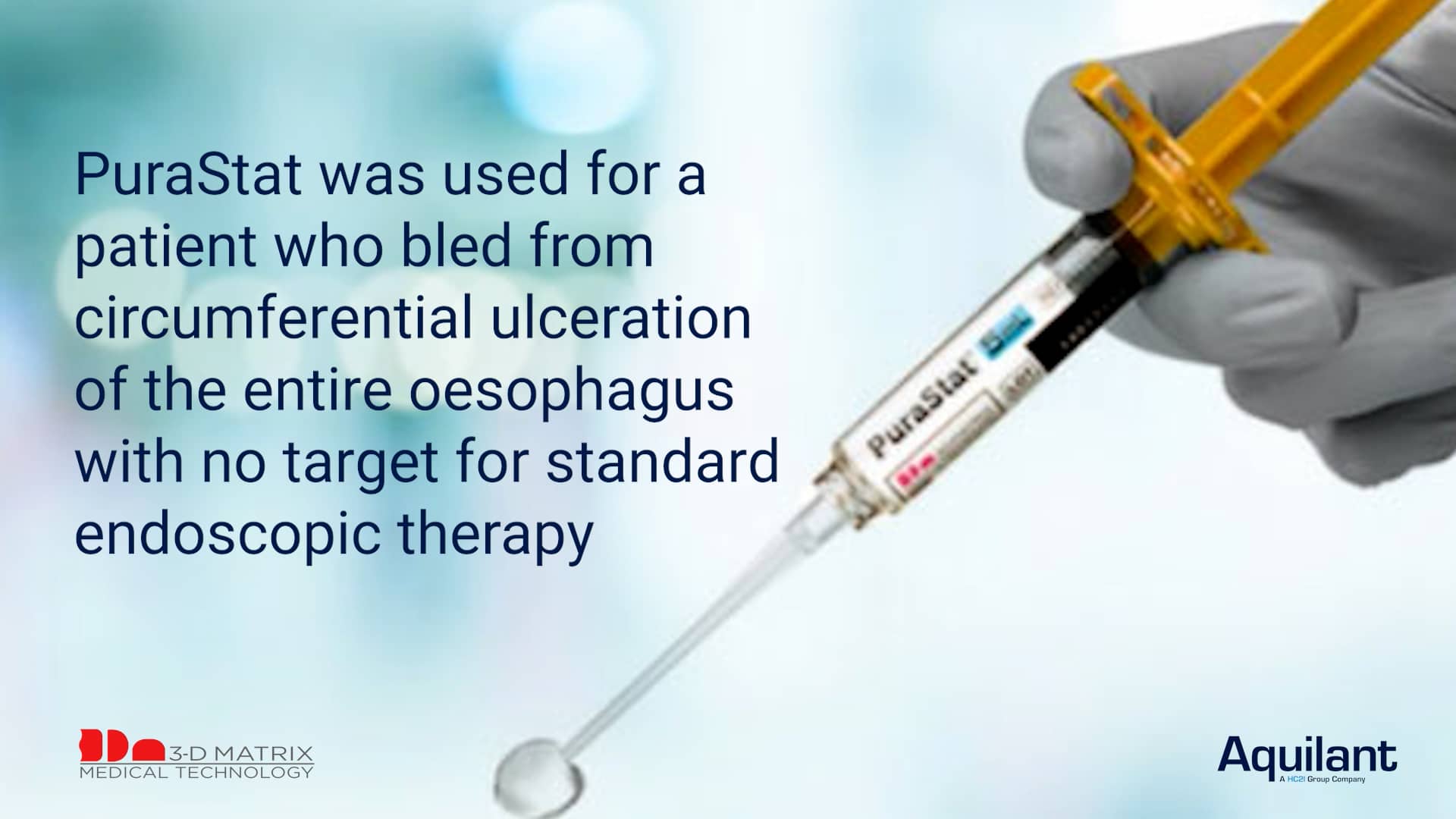 PuraStat as a treatment option for circumferential ulceration of the ...