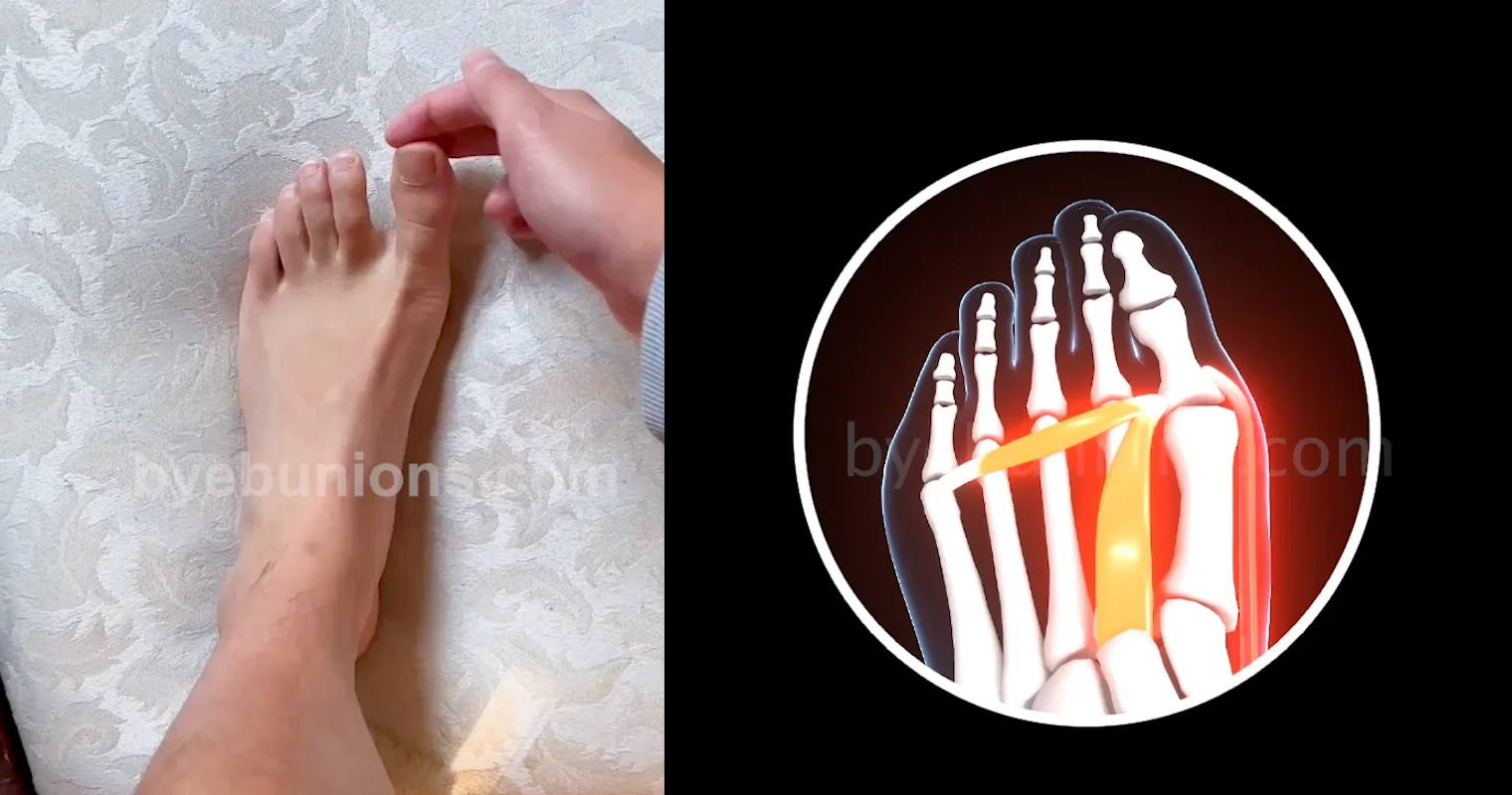 spring-watermark on Vimeo