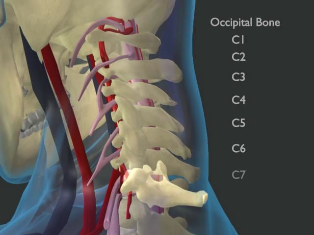 Neurosurgery Animation For Attorneys on Vimeo