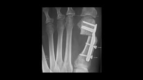 Resources | Novastep International