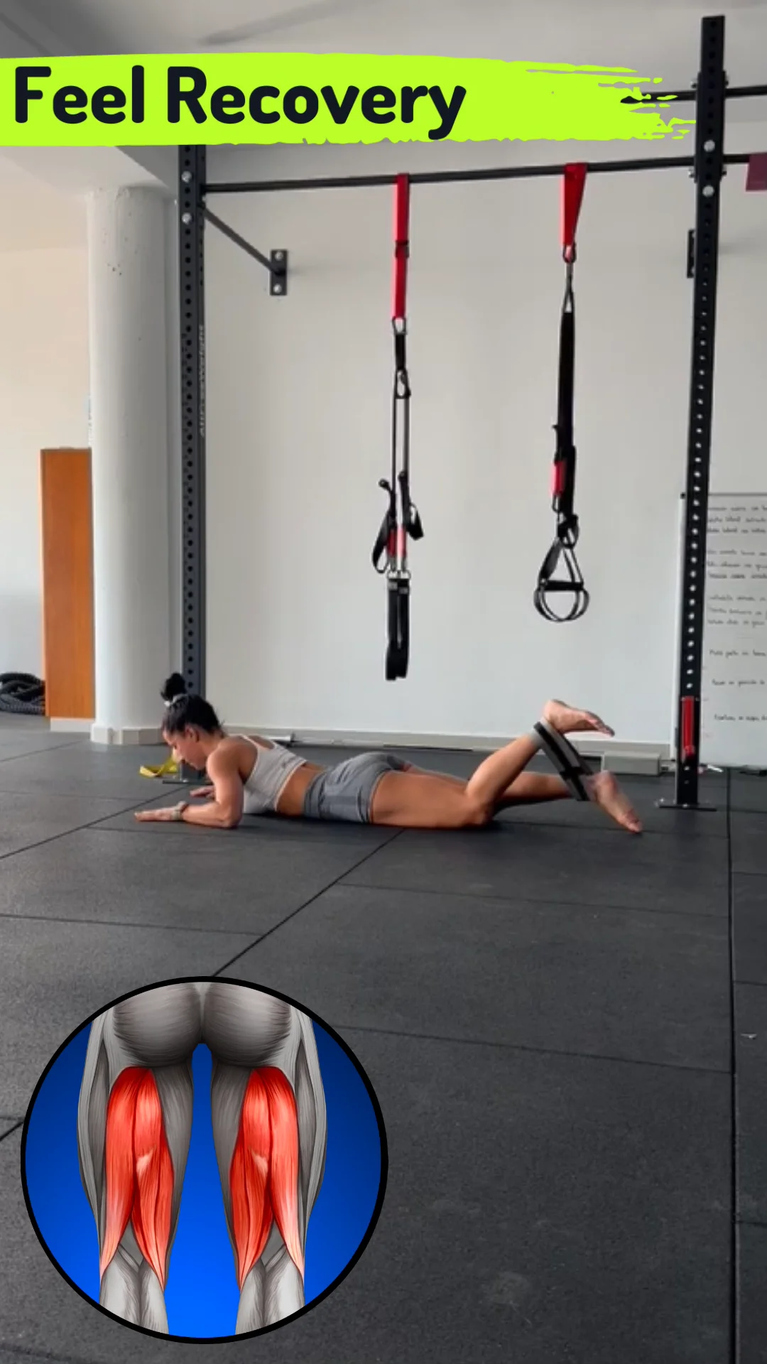 Hamstring Curl in Prone (Bands)