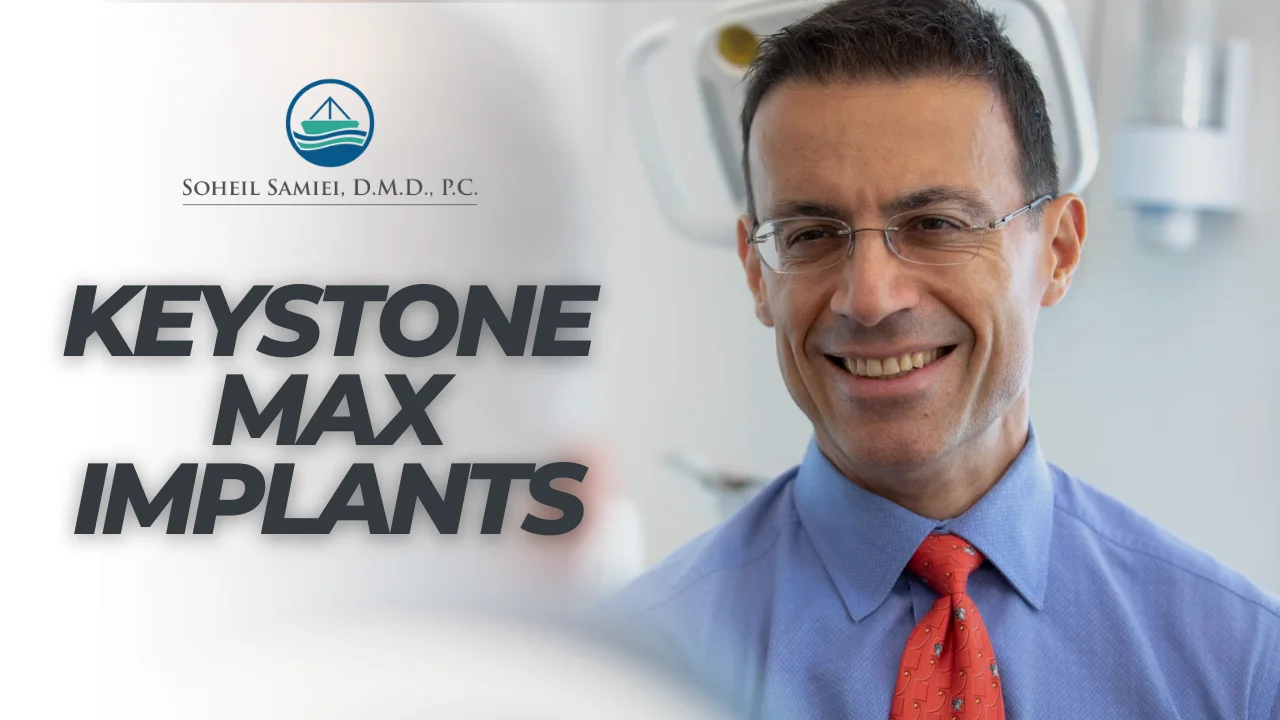 Keystone Max Implants Provide Amazing Outcomes