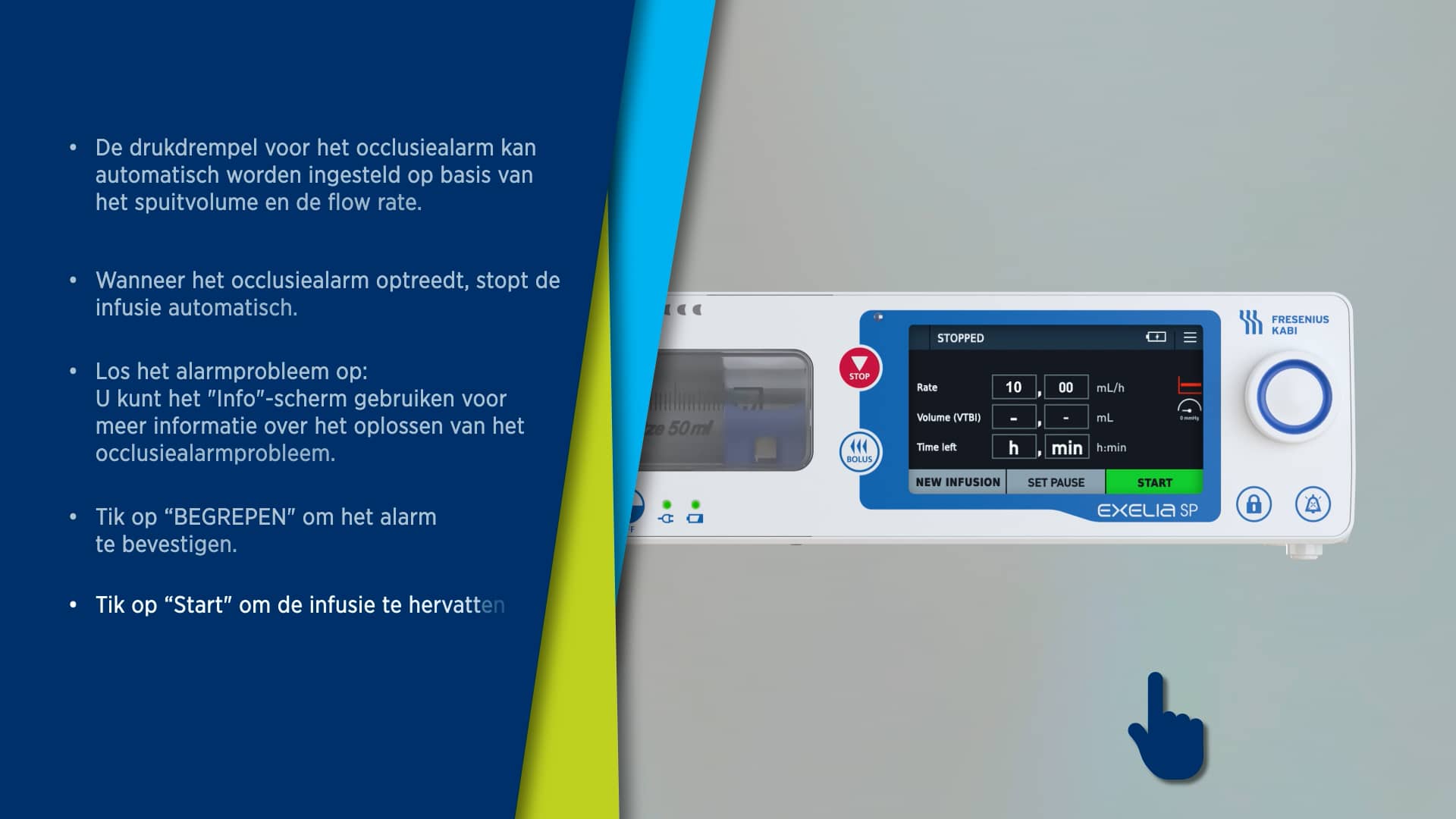 25_Exelia SP - Occlusie alarmen on Vimeo