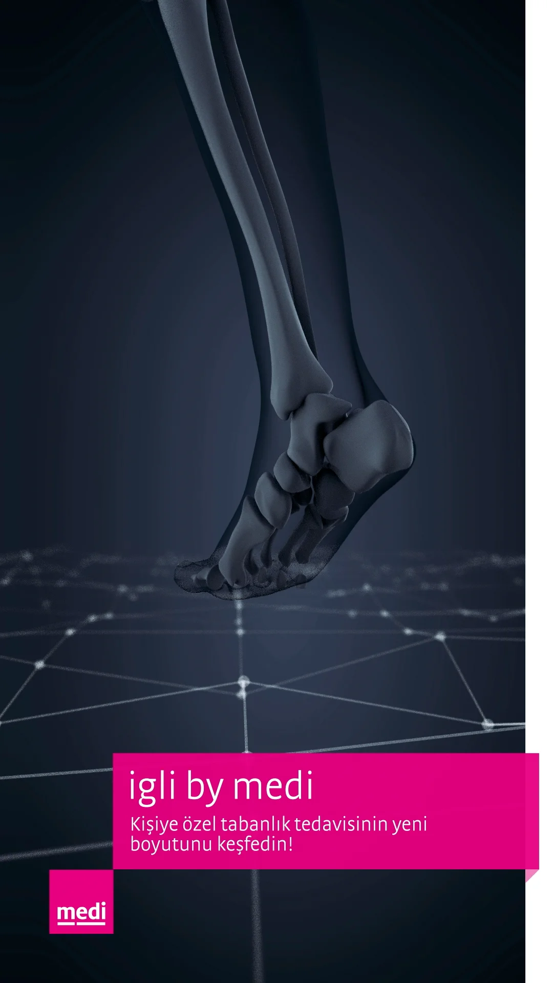 İgli by medi - Kişiye özel karbon tabanlık konsepti on Vimeo