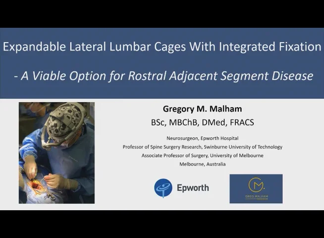 expandable-lateral-lumbar-cages-with-integrated-fixation-a-viable ...