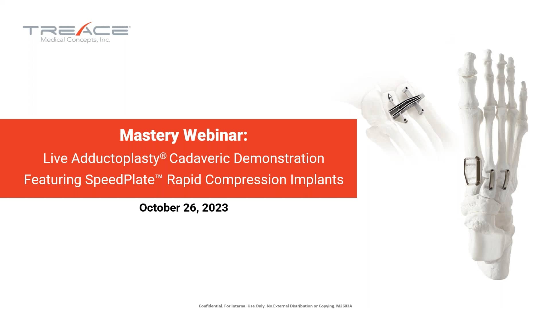 Mastery Webinar_ Live Adductoplasty® Cadaveric Demonstration Featuring ...