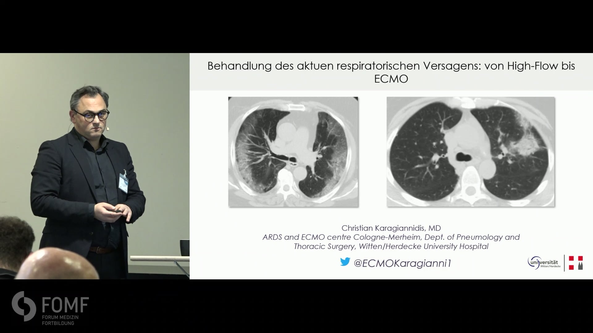 Dyspnoe und Husten | CME Video Fortbildung für Ärzte