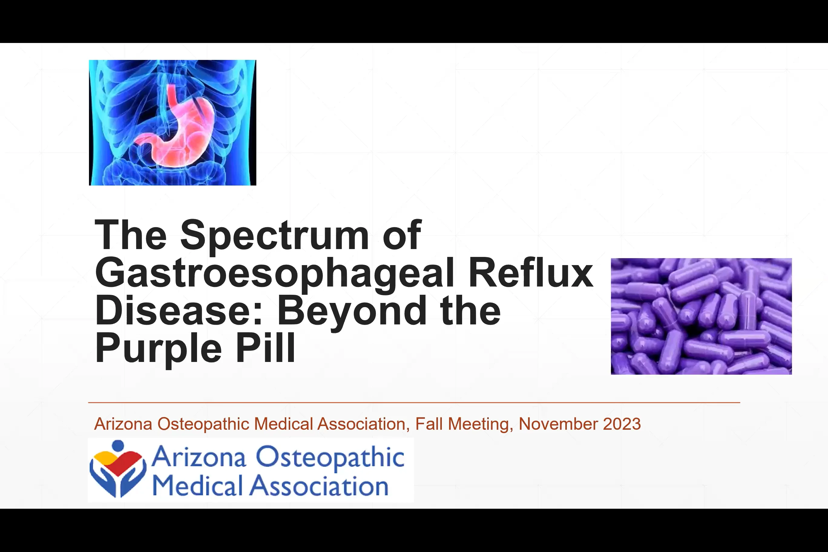 The spectrum of gastroesophageal reflux disease: Beyond the purple pill ...
