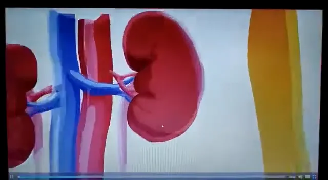 Kidney Video.mp4 on Vimeo