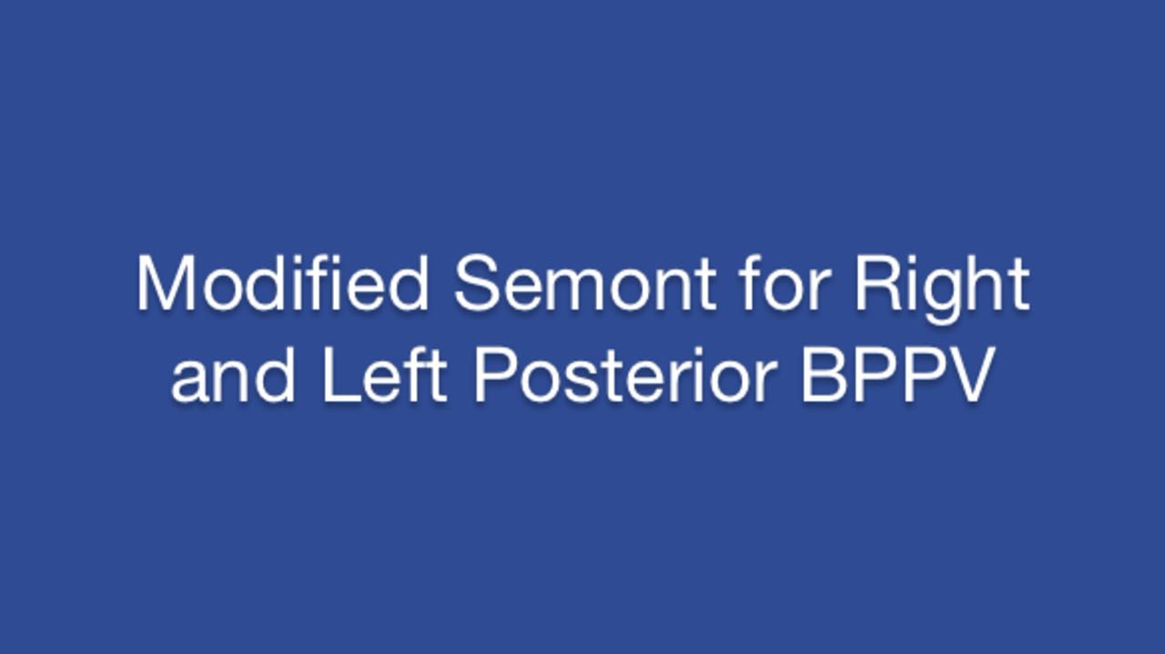 Modified Semont Maneuver for Bilateral Posterior BPPV on Vimeo