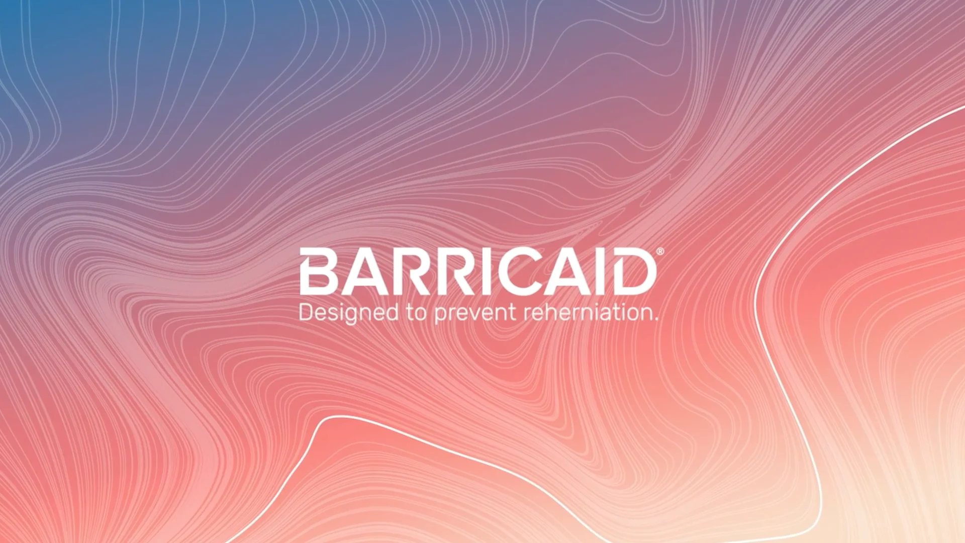 Barricaid Surgical Technique Animation on Vimeo