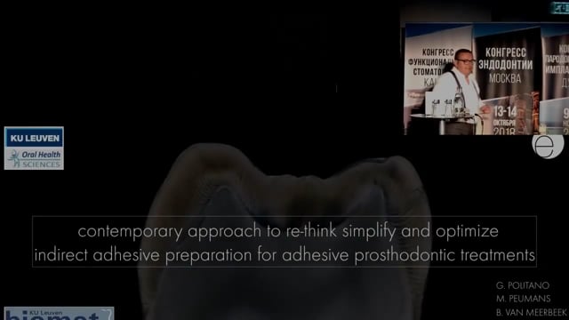 Gianfranco Politano online course: bio-emulation, veneers