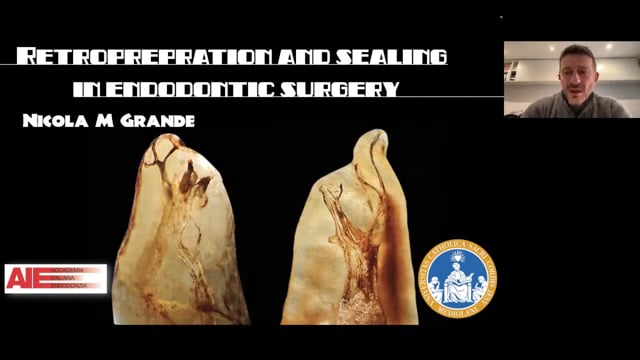 Webinar on retro-preparation, pain control in apical surgery