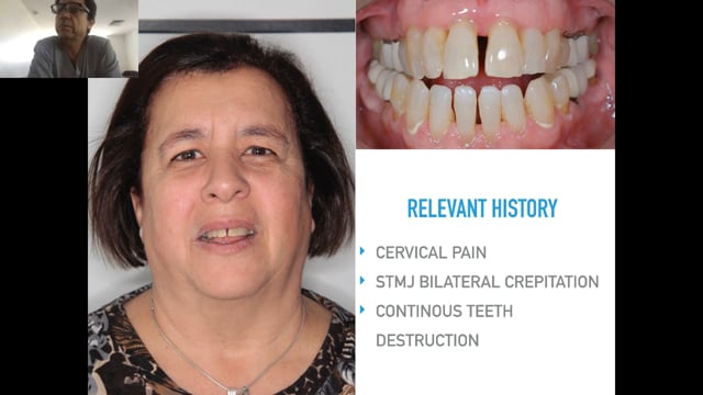 Treatment of TMD, cervical problems, splint therapy, webinar