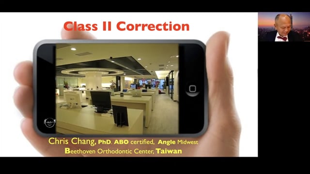 Webinar on class 2 correction, treatment using microimplants