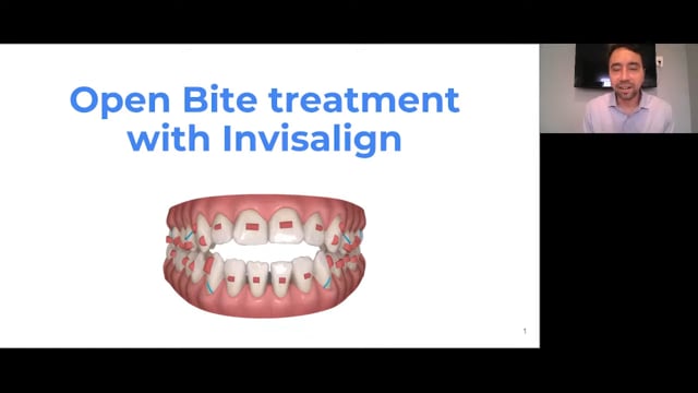 Webinar: the open bite treatment with Invisalign®, Clincheck