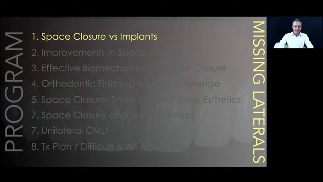 Lateral incisor adentia and canine camouflage, online lesson