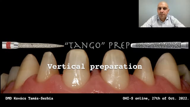 Vertical preparation, temporary prosthetics: online course