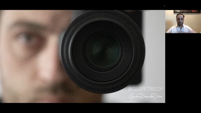 Contact point: effective posterior teeth direct restoration technique