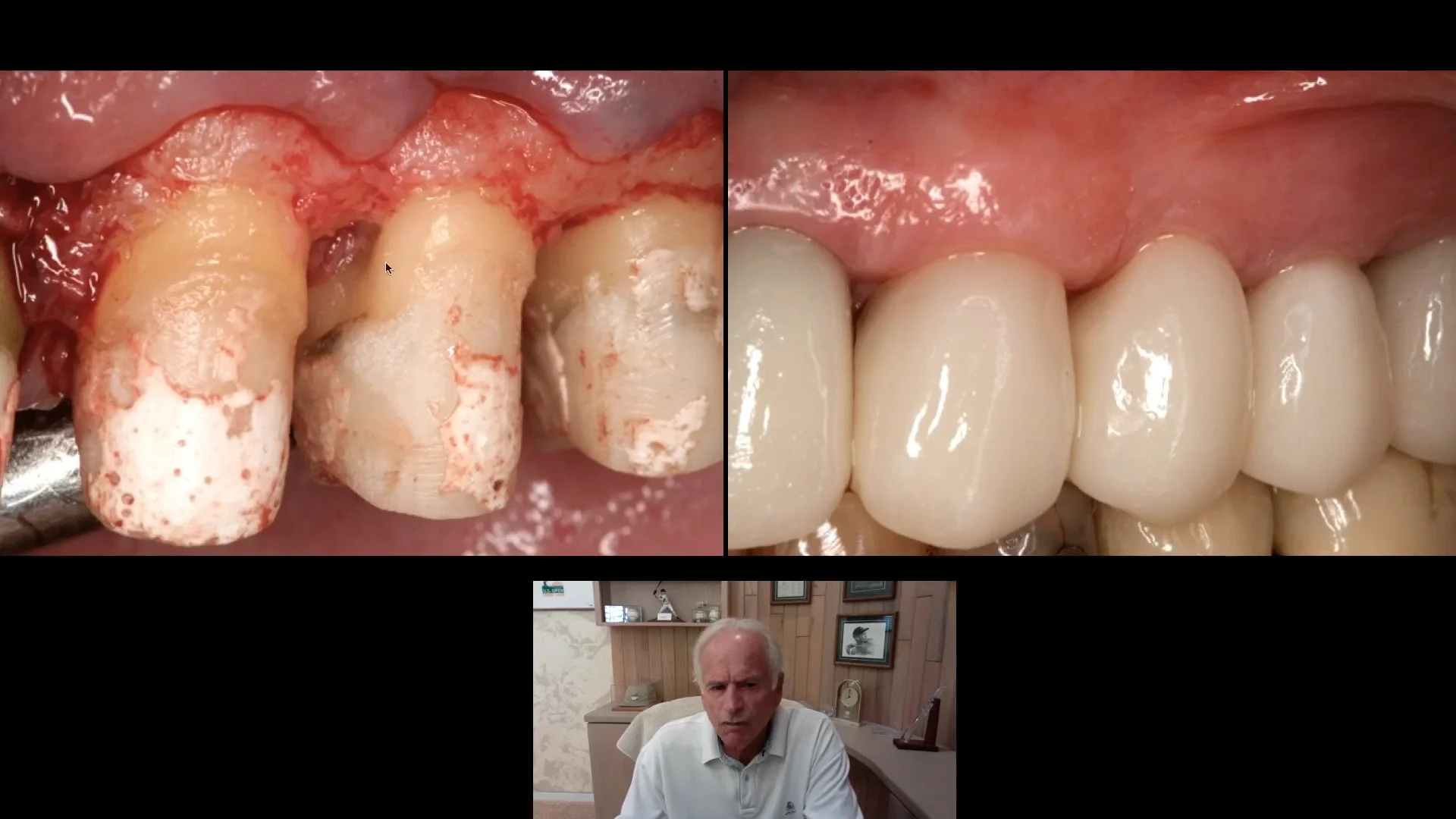 BIOLOGIC SHAPING. PART 2