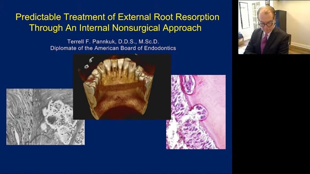 Webinar on external root resorption, application of MTA
