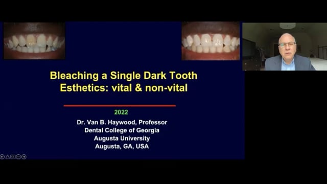 Vital, non-vital, intracanal bleaching techniques, webinar