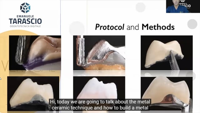 Metal ceramic crown creation techniques, VertiPrep, webinar