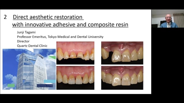 Adhesive protocols, composite restorations, online lesson