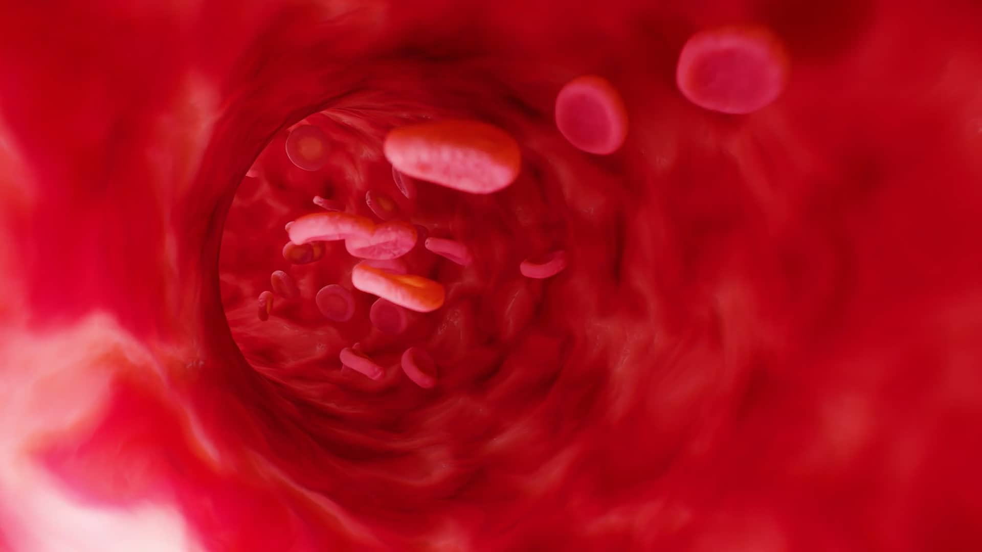 Dr Constantino Pena 15 WHAT IS PAD on Vimeo