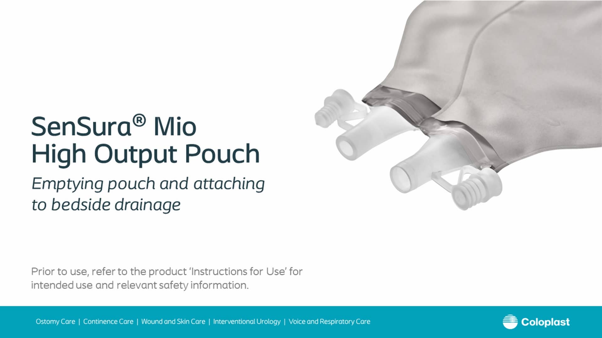SenSura® Mio High Output Pouch - emptying and attaching to bedside drainage on Vimeo