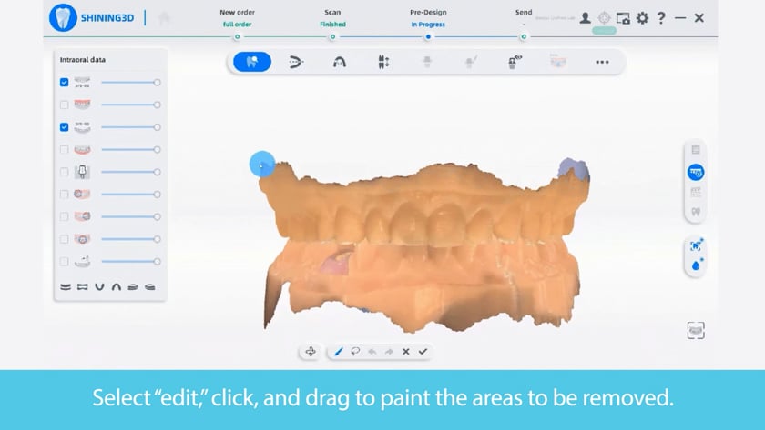 Shining® Quick Reference Videos - Dental Crafters