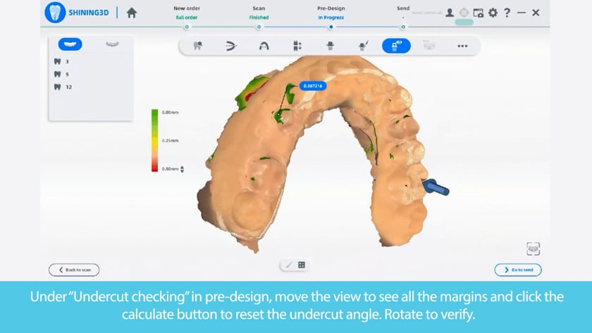 Shining® Quick Reference Videos - Dental Crafters