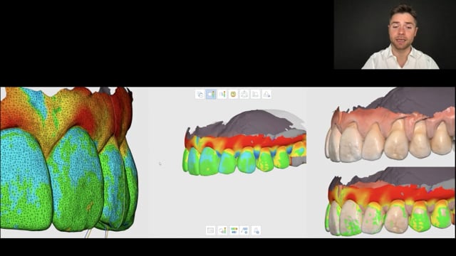 Introduction to the Prostho-Digital Treatment Approach
