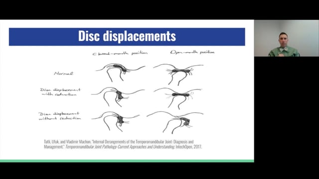 Osteopathic treatment approach to craniofacial dysfunction