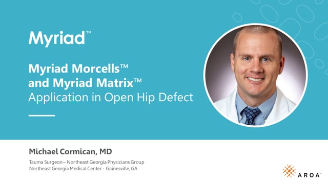 Myriad Matrix™ | AROA