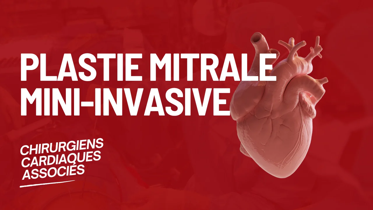 Plastie mitrale mini-invasive