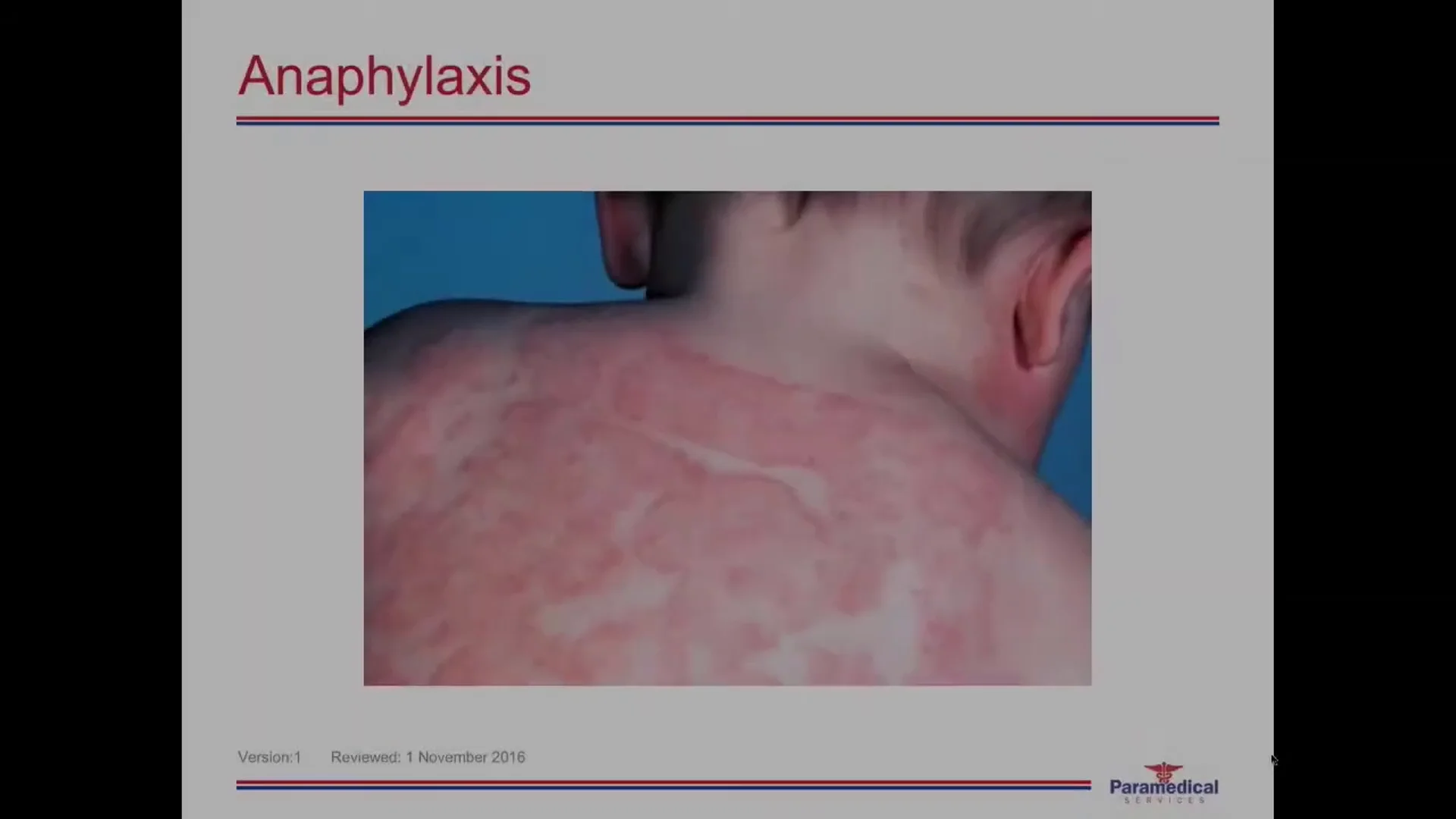 2024 Q1 Allergies OTEP