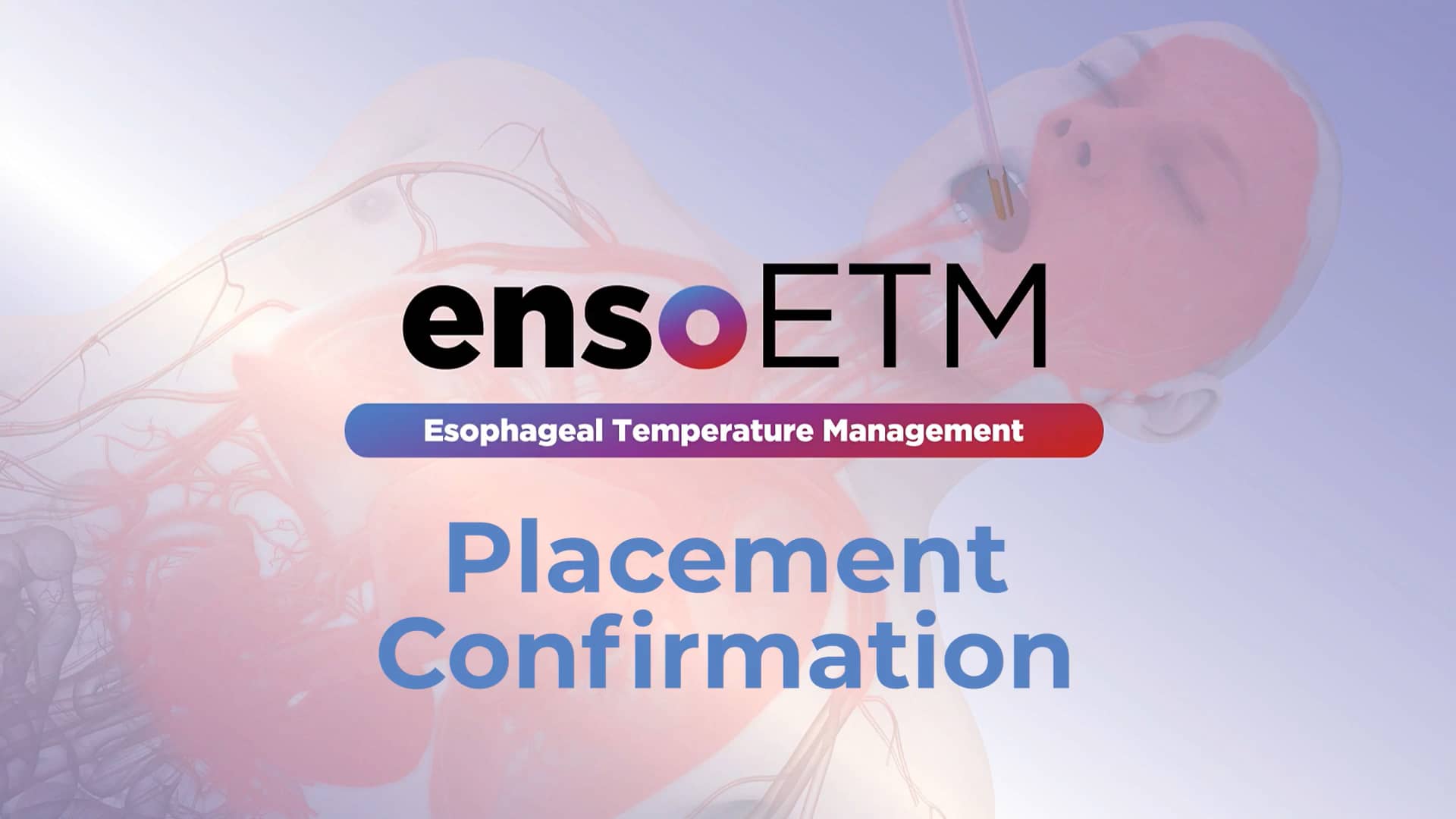 Confirming ensoETM® Placement on Vimeo
