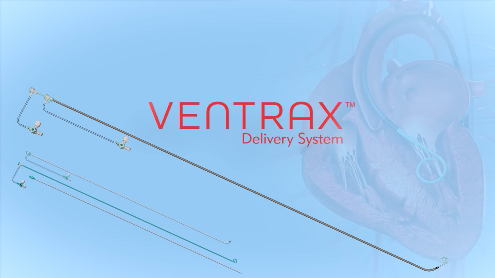 Introducing the Ventrax™ Delivery System